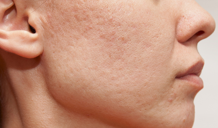 4 Most Amazing Beauty Benefits of Carrots - lifeberrys.com