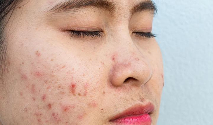 4 Most Amazing Beauty Benefits of Carrots - lifeberrys.com