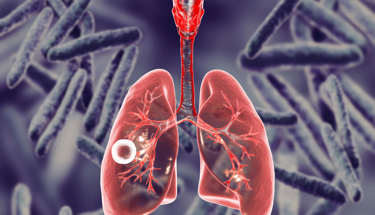 6 Most Common Causes of Chest Congestion - lifeberrys.com