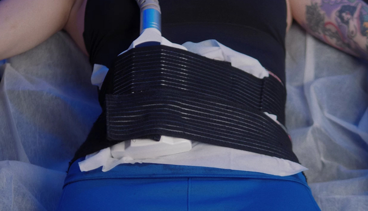 How a Cold Fat Reduction Machine Works - lifeberrys.com