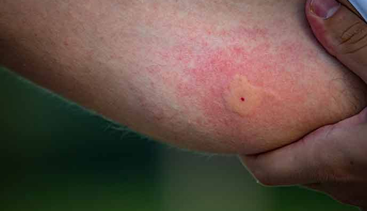 6 Least Known Benefits of Plantain Herb for Skin and Hair - lifeberrys.com