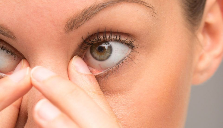 11 Home Remedies To Treat Burning or Irritated Eyes - lifeberrys.com