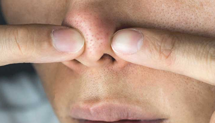 Some Common Symptoms of Sinonasal Cancers - lifeberrys.com