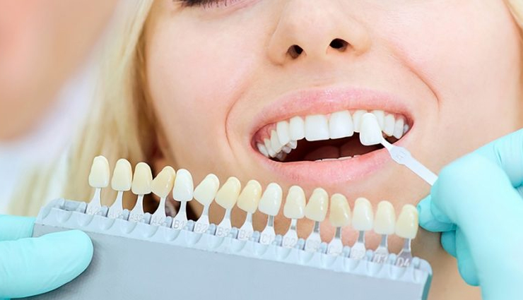 Causes of Yellow Teeth and 8 Effective Home Remedies to Whiten Them ...