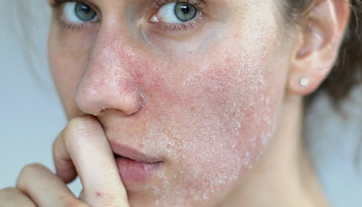 6 Amazing Benefits of Using Baking Soda for Skin - lifeberrys.com