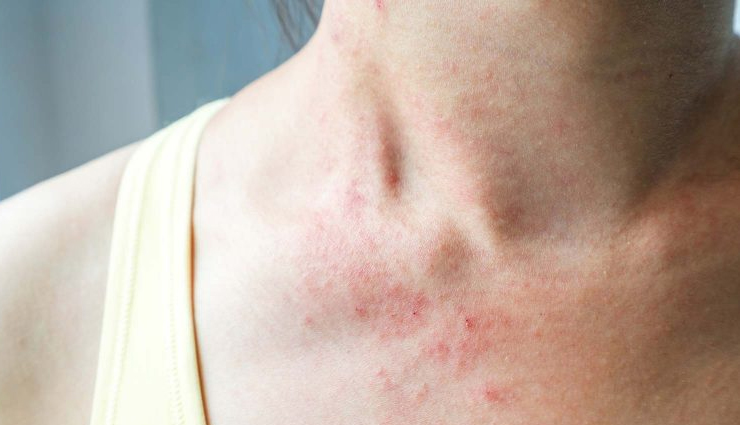 15 Benefits Of Using Almond Oil For Skin And Hair - lifeberrys.com