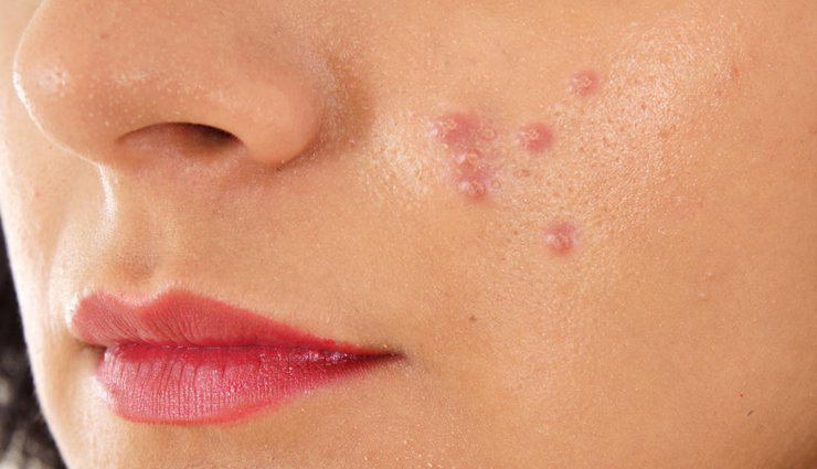 5 Common Skin Problems Listed Here - lifeberrys.com