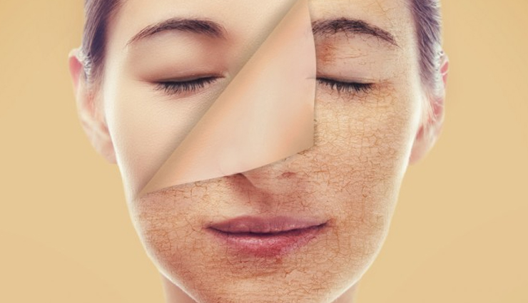 6 Amazing Benefits of Washing Face With Rice Water - lifeberrys.com